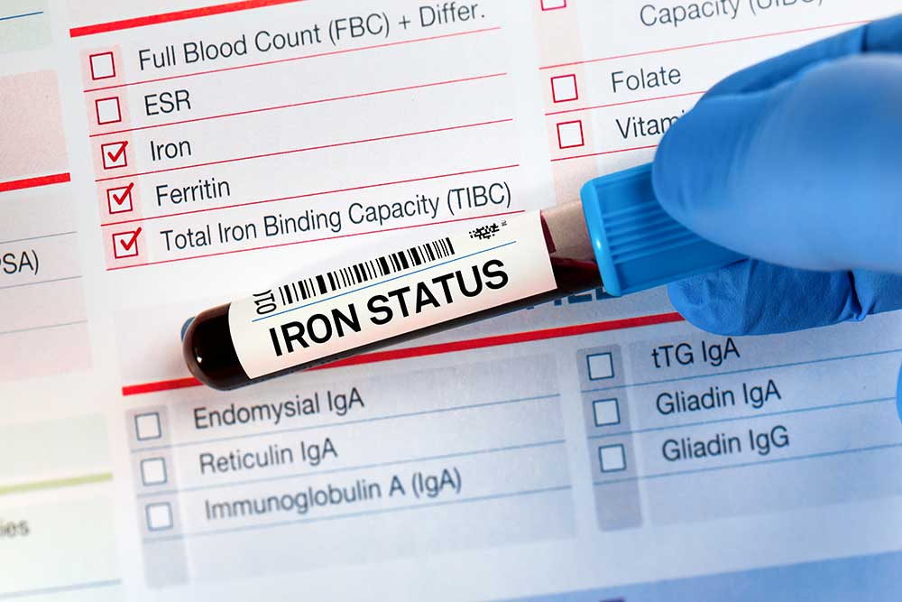 Iron Status | On Call Doctors