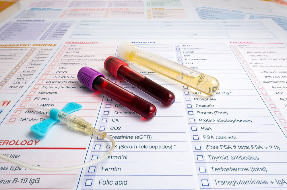 Complete STI Check | On Call Doctors